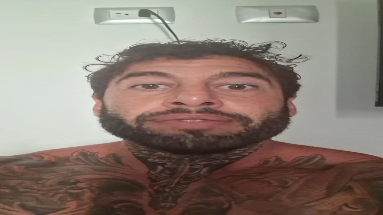 CHRIS SKY EXCLUSIVE RED ALERT The "Rabies" like diease from the bio ...